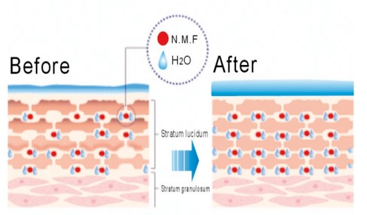 Polyglutamic Acid: A “Better Alternative” to Hyaluronic Acid for ...
